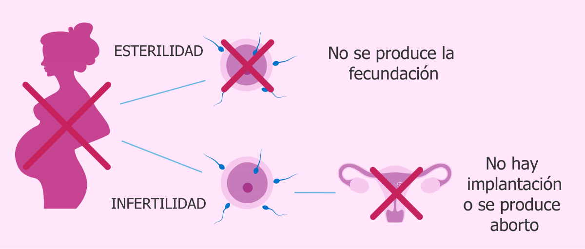 Que es Esterilidad femenina causas | SERMA SUBROGACIÓN MÉXICO